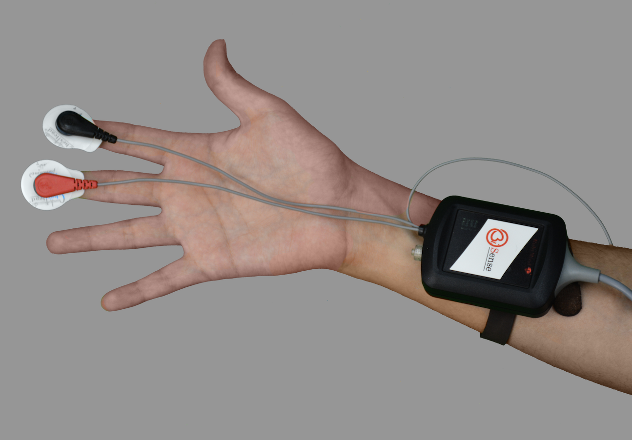 Sistemas de Biofeedback y Neurofeedback Clásico